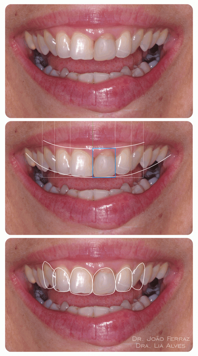 DSD_facetas - Dra. Lia Alves Schinetski